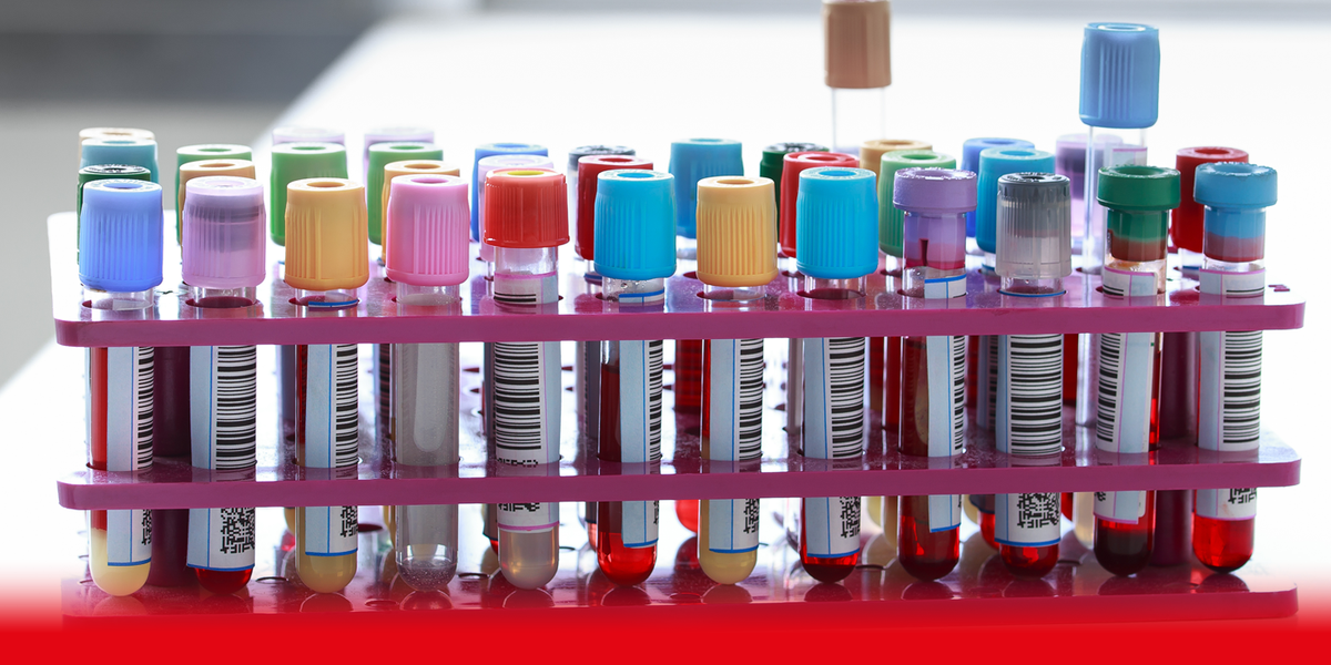 How Long Does a Full Blood Panel Take? | One Day Tests — onedaytests.com