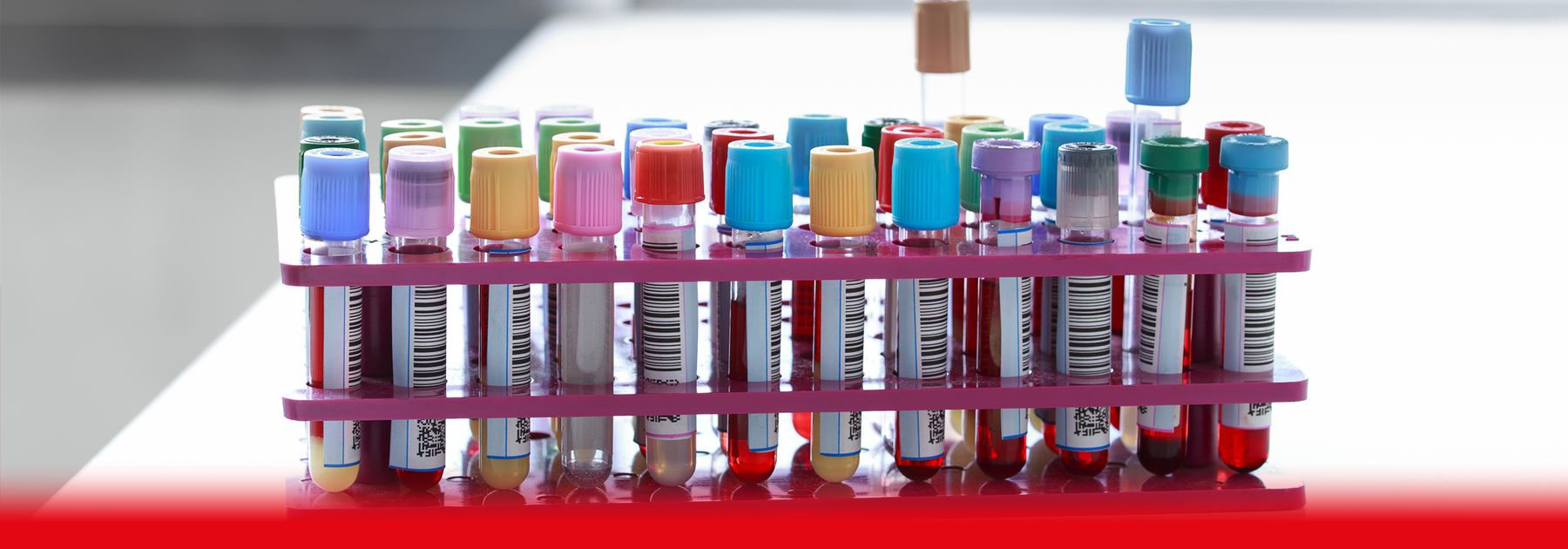 How Long Does a Full Blood Panel Take? | One Day Tests — onedaytests.com