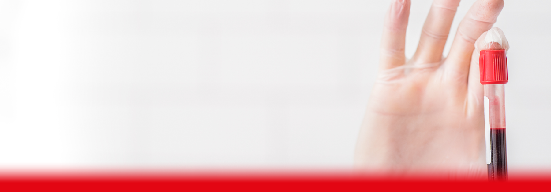 What Blood Tests Are Done on an NHS Health Check? | One Day Tests ...