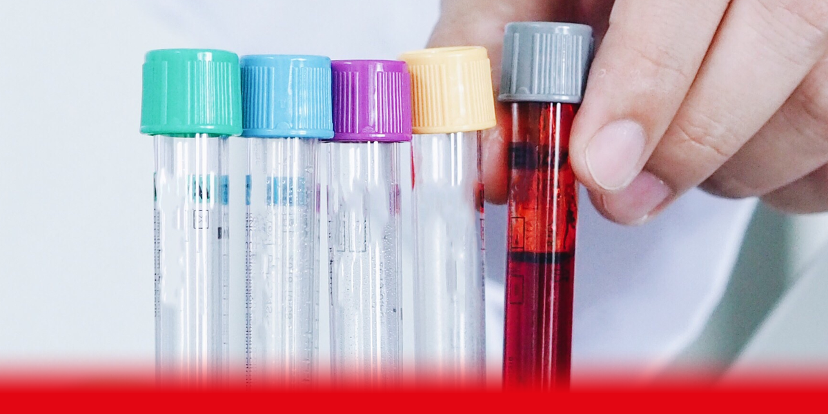 What Blood Test Are Done For Menopause | One Day Tests — onedaytests.com