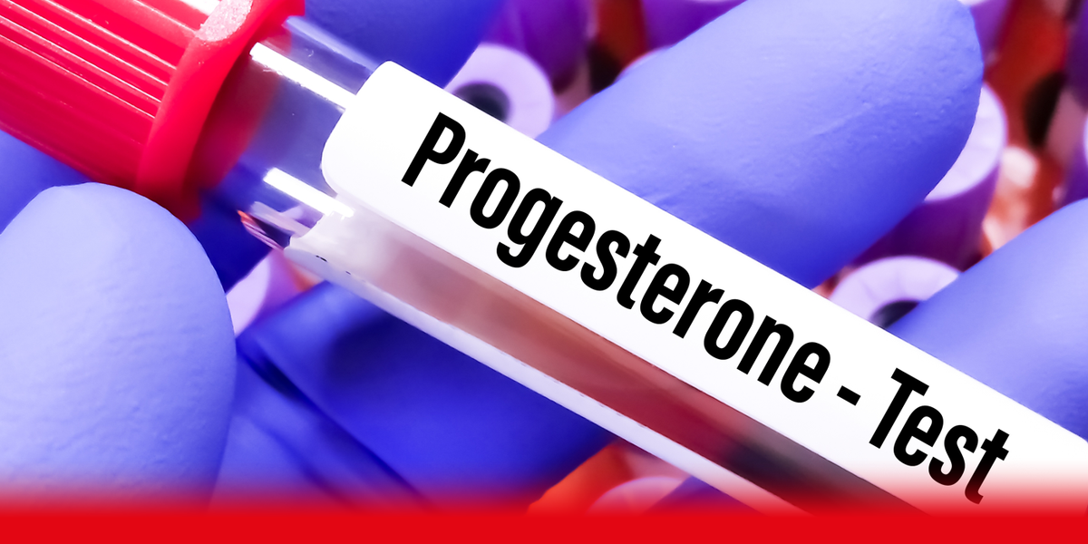 How To Interpret A Progesterone Blood Test | One Day Tests ...