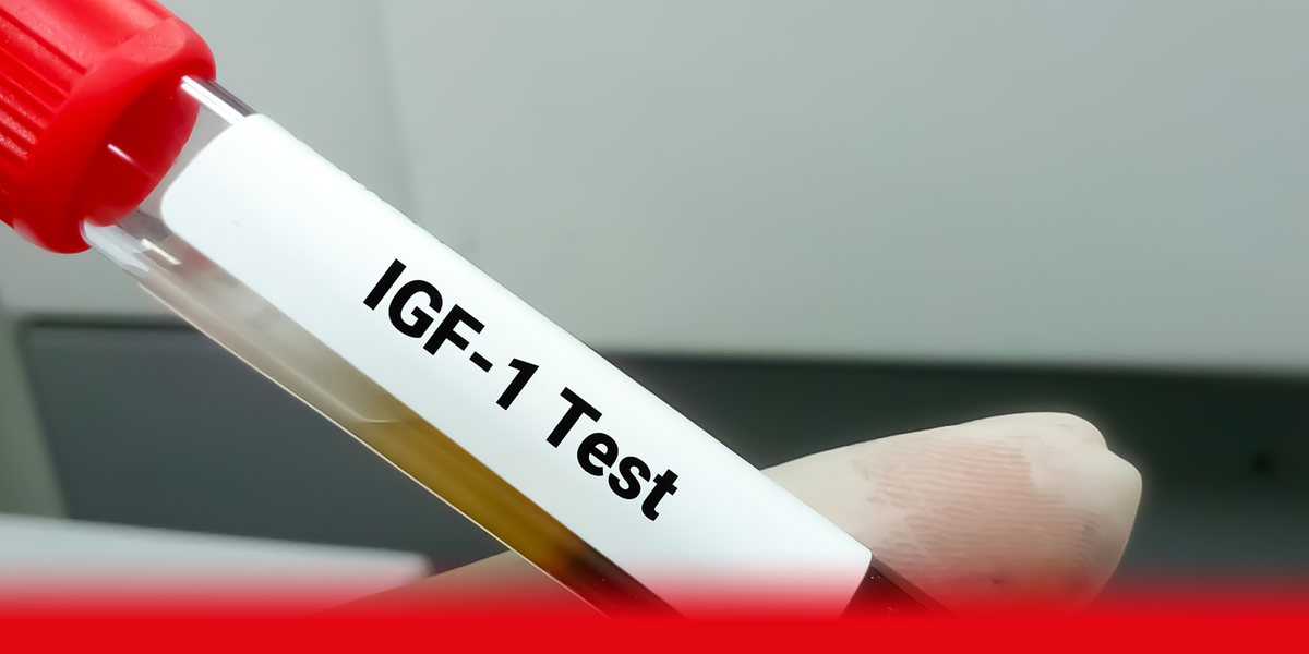 What Is An IGF 1 Blood Test? | One Day Tests — onedaytests.com