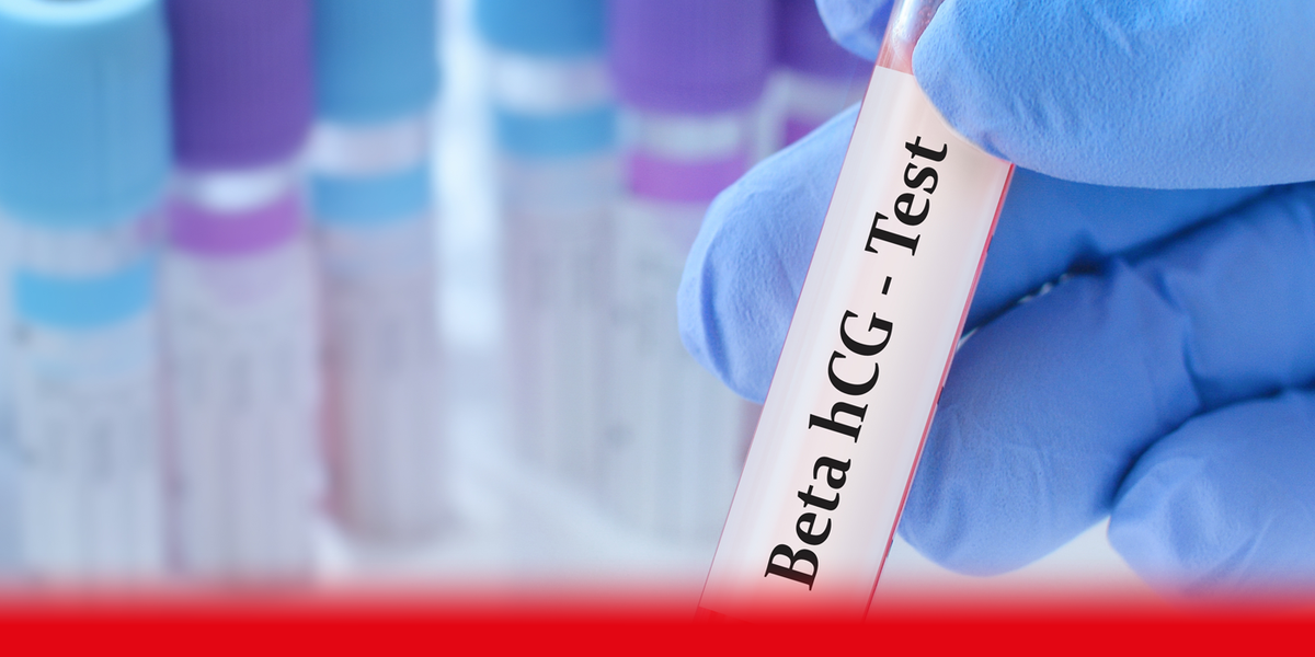 What Does a hCG Blood Test Tell You | One Day Tests — onedaytests.com