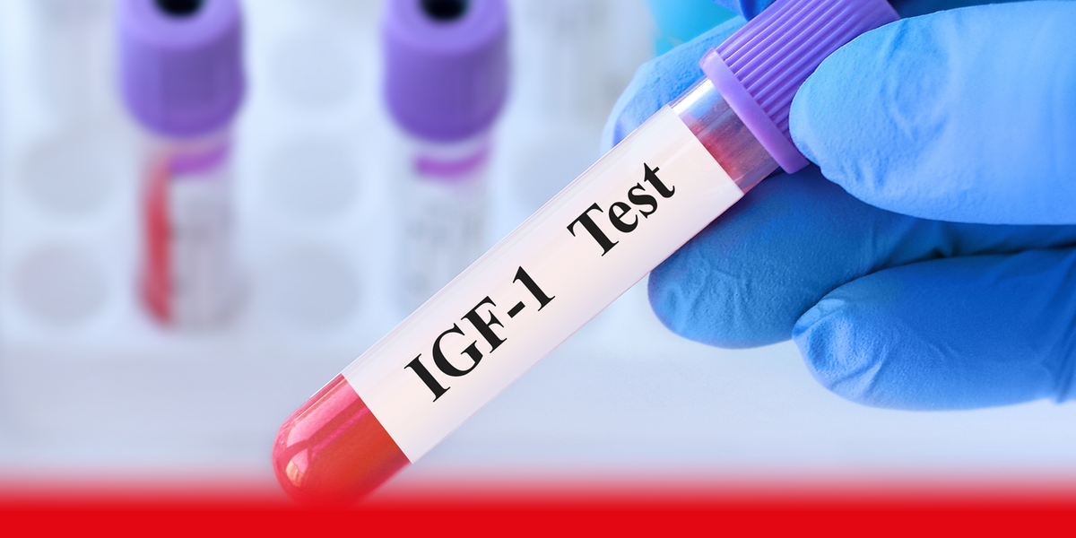 What Does It Mean When Your IGF 1 Is High? — onedaytests.com