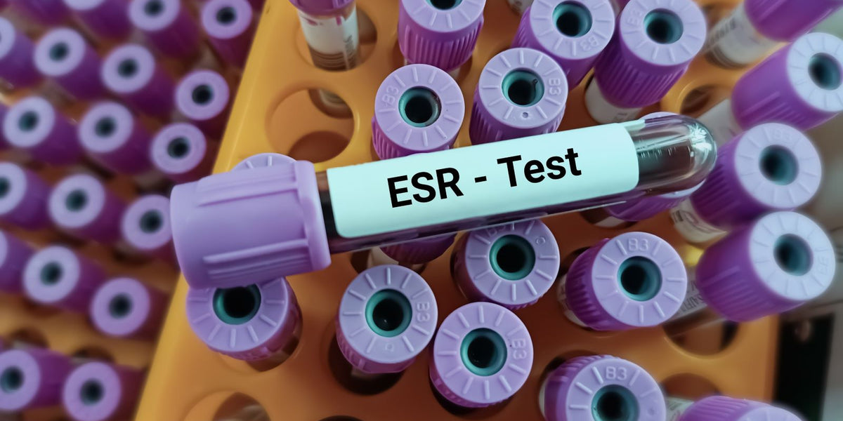 Understanding the ESR Blood Test | Importance & Insights — onedaytests.com