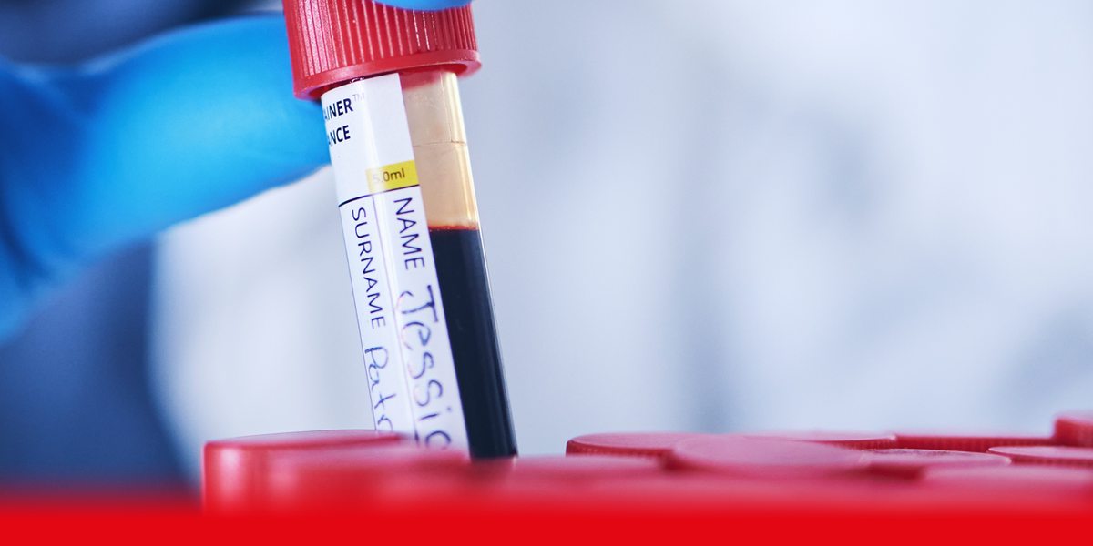 What Is a LH and FSH Blood Test for a Woman | One Day Tests ...