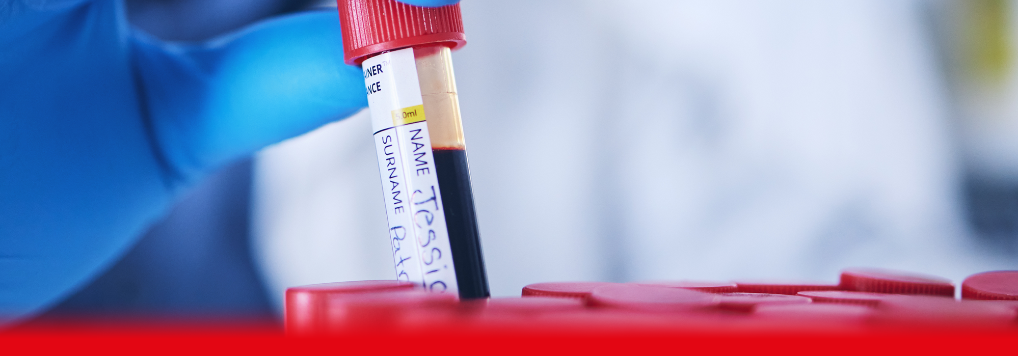What Is a LH and FSH Blood Test for a Woman | One Day Tests ...