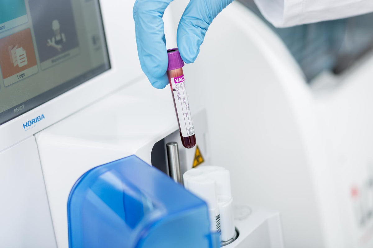 The Basics of Blood Testing Explained — onedaytests.com