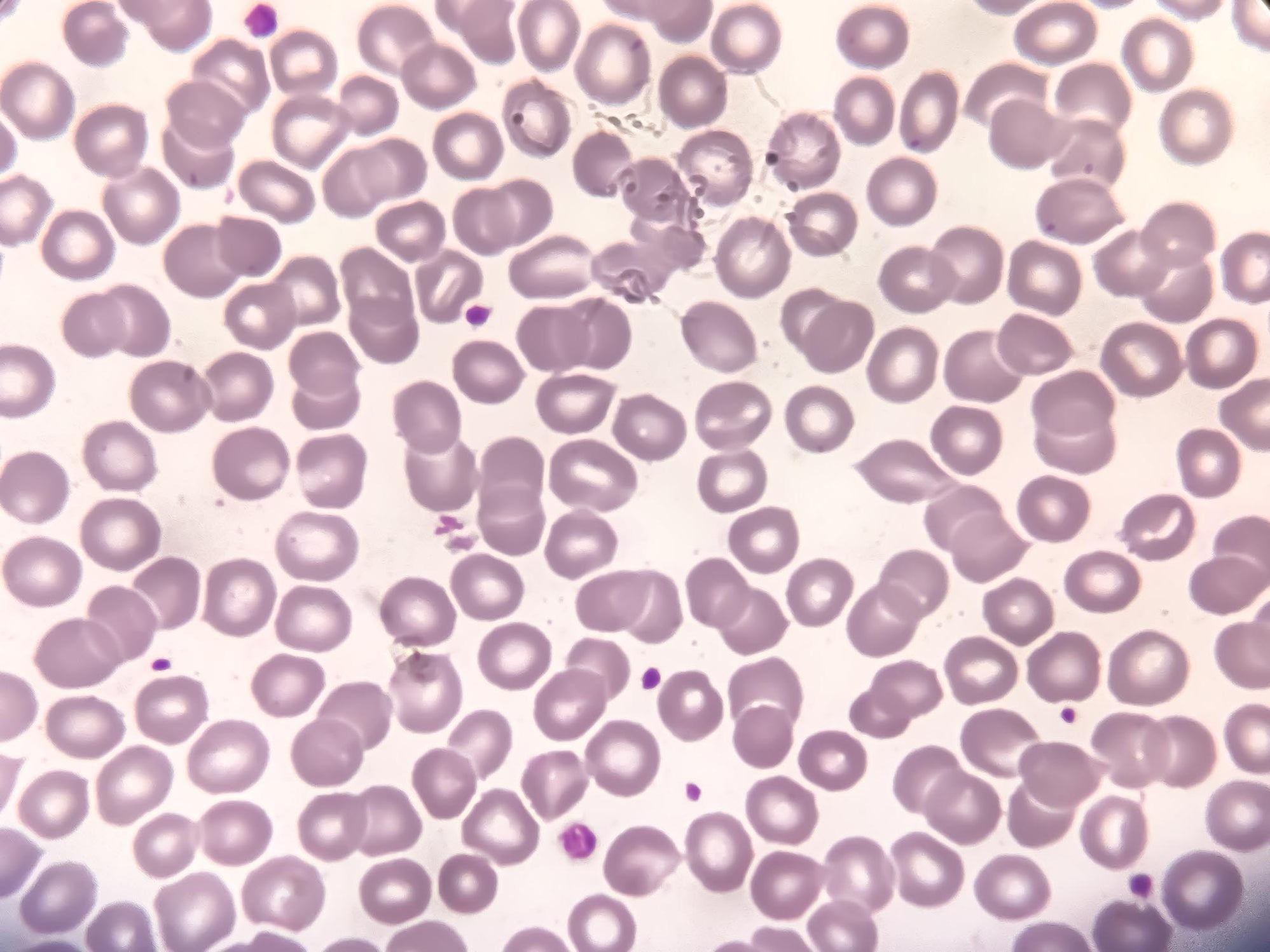 Blood film analysis and differential count — onedaytests.com